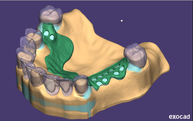 Design Center - May Dental Technology Co.,Ltd