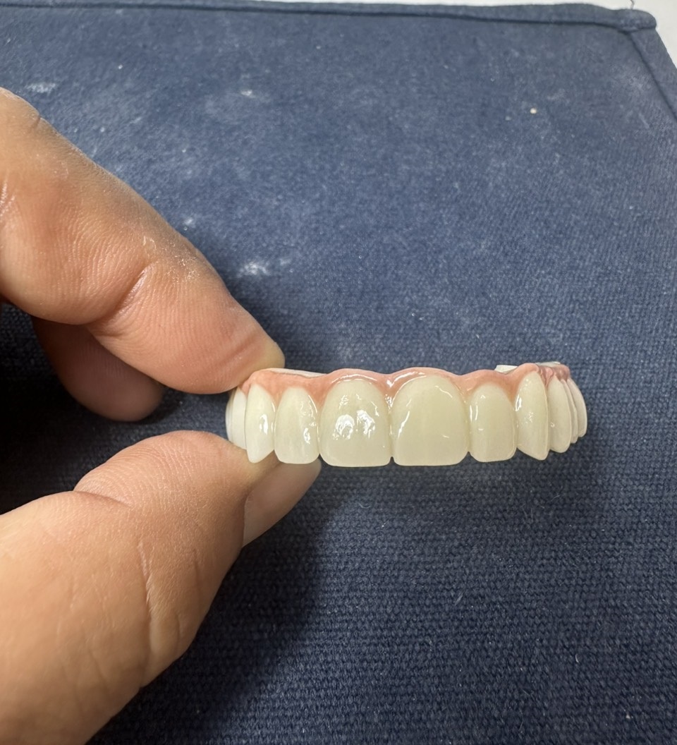 Full Arch Case with Katana Multilayer Zirconia - May Dental Technology ...